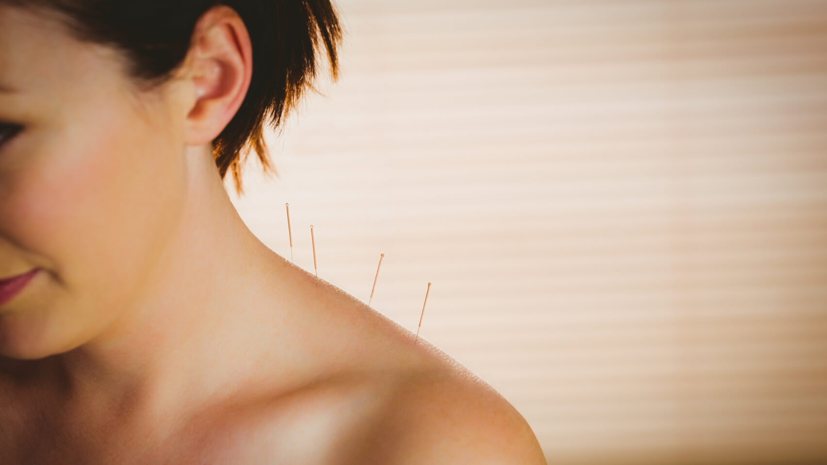 What is Acupuncture? | DelCollo Acupuncture